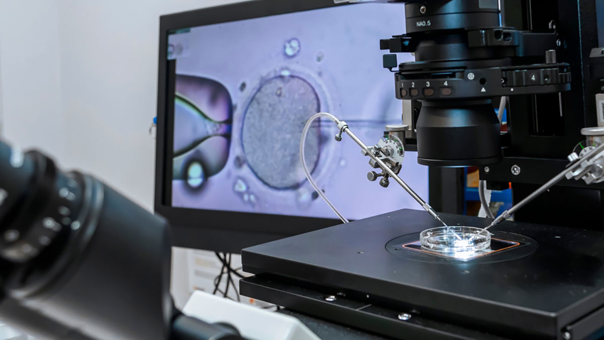 Programul național FIV 2022-2023: Tot ce trebuie să știi